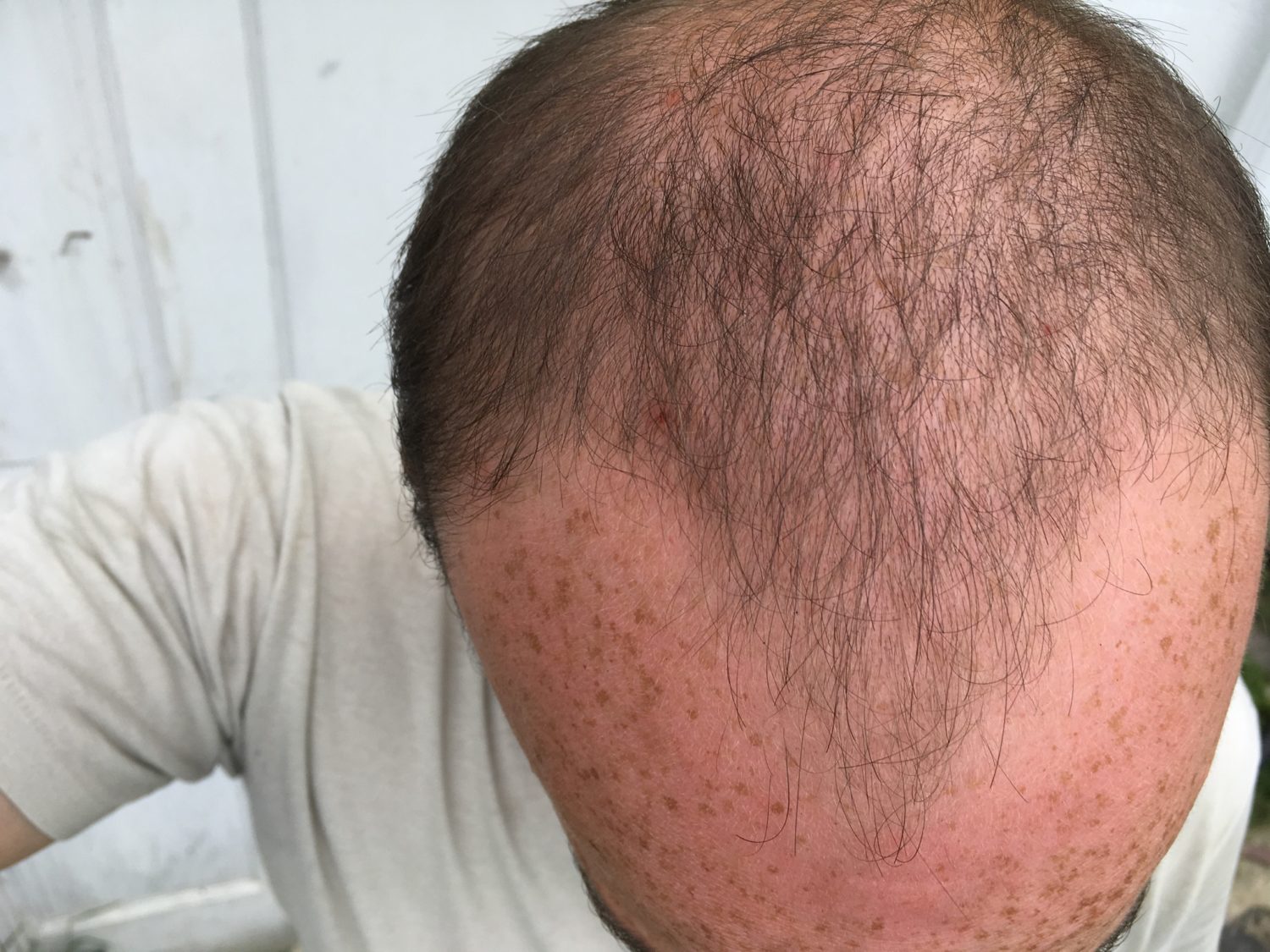 Stem Stim Hair Growth Serum – The Longevity Edge