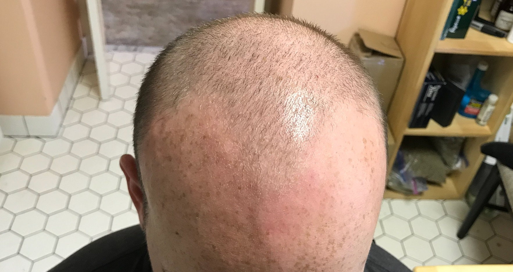 Stem Stim Hair Growth Serum – The Longevity Edge